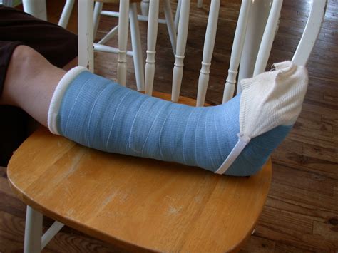 Rurification Robin Edmundson Project A Boot For A Cast