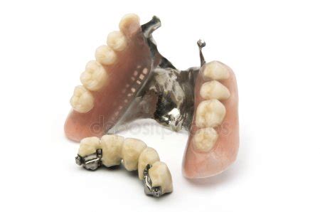 Combined Fixed And Mobile Prosthesis Stock Photo By Qazix1 3123206