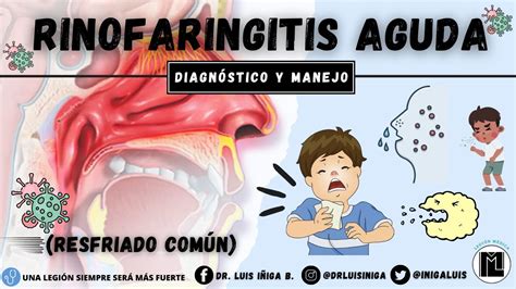 Rinofaringitis Aguda Resfriado Común Etiología Patogenia Clínica