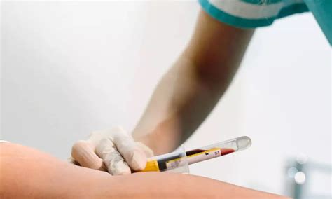 High Good Cholesterol Linked To Lower Statin Use In At Risk Adults