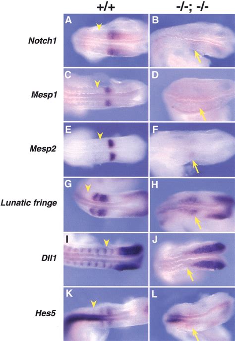 The Murine Winged Helix Transcription Factors Foxc1 And Foxc2 Are