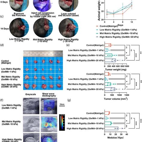 Extracellular Matrix Rigidity Promotes Emt And The Tumor Download Scientific Diagram