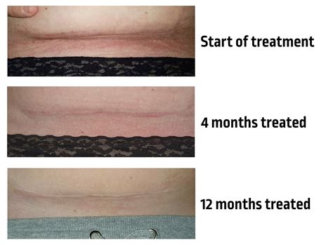 Patch Dermatology