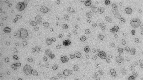 Urinary Extracellular Vesicles Image Eurekalert Science News Releases