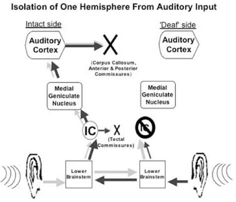 Figure 1 From Exploring The Extent And Function Of Higher Order Auditory Cortex In Rhesus