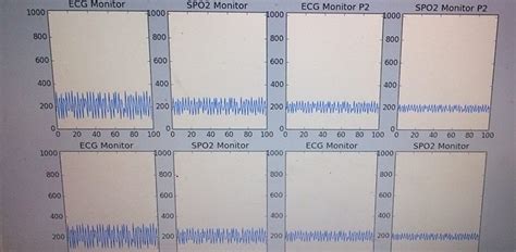Software Part Element14 Community