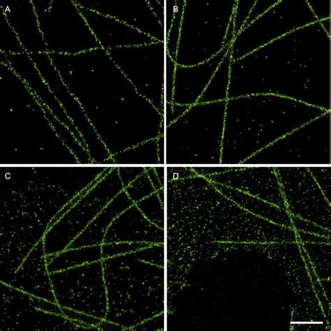The Timing Of Permeabilization Of Cells Significantly Affects The