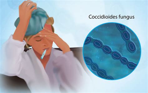 Health Condition Symptoms Causes Treatment And More