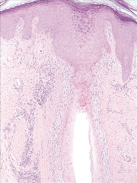 Dendritic Cells Histology