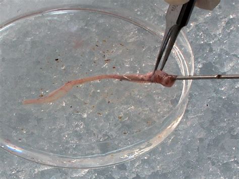 Video Isolation Of Primary Myofibroblasts From Mouse And Human Colon Tissue