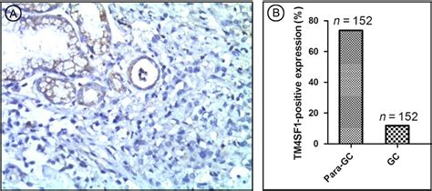 Clinical Significance Of TM4SF1 As A Tumor Suppressor Gene In Gastric