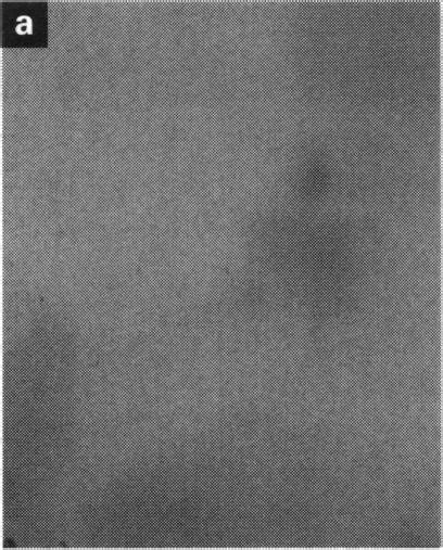 Representative Autoradiograms Of 32p Labeled Hepatic Dna Digests From