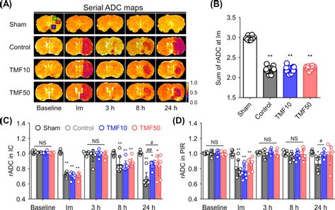 Effect Of TMF Treatment On Apparent Diffusion Coefficient ADC Values Download Scientific