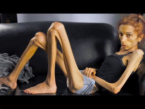Who Is The Worlds Thinnest Person Among Us