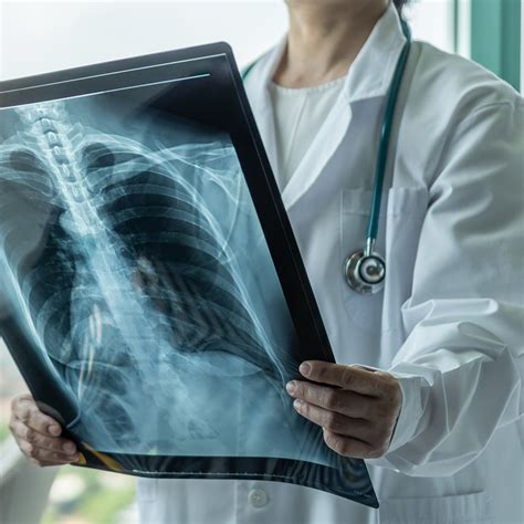 Em Assembleia Simers Apresenta Proposta Da Santa Casa Para Radiologistas