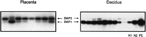 Semi Quantitative Reverse Transcriptionpolymerase Chain Reaction