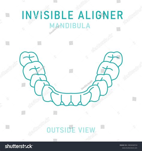 Orthodontic Silicone Trainer Invisible Braces Aligner Stock Vector