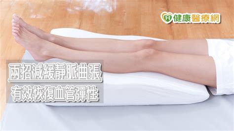 3大錯誤迷思當心惡化靜脈曲張 多做2件事助恢復血管彈性 健康醫療網