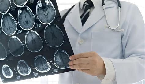 Nihss National Institutes Of Health Stroke Scale Test