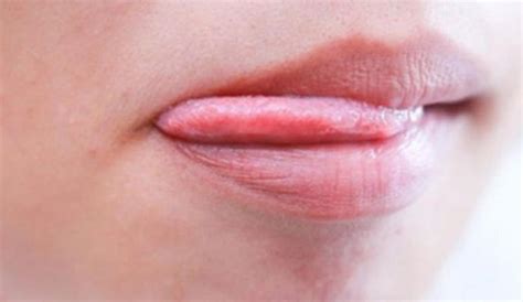 嘴唇总是干裂、起皮，喝水、抹唇膏都没用？可能和你的这两个脏腑有关！ 知乎