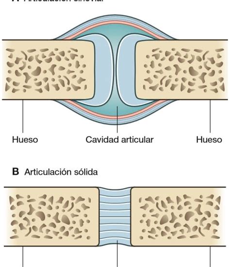 Sinovitis Todo Lo Que Debes Saber Sobre La Membrana Sinovial Inflamada