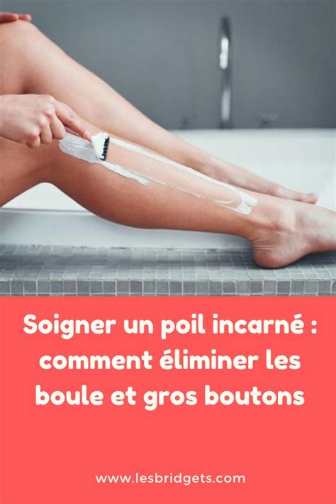 Soigner un poil incarné éliminer boule et gros boutons Poil incarné