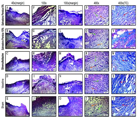 Representative Photomicrographs Of Histopathological Evaluation Of