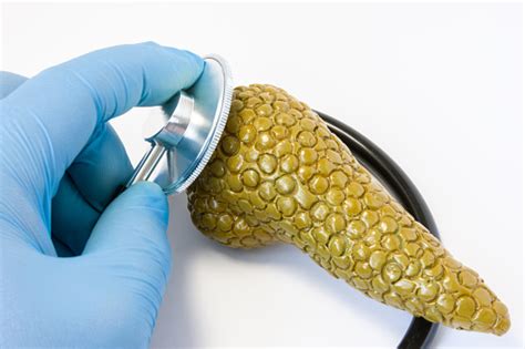 청진 기 및 3d 모양 췌의 장갑에는 의사의 손 사진 아이디어 어디 의사 또는 일반 개업의 수술 전 진단 또는 췌 장 동맥의 질병의 진단 실시 3차원 형태에 대한 스톡 사진