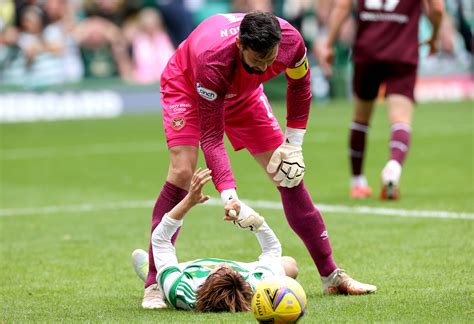 Former Celtic Goalkeeper To Undergo Surgery As He Plots Comeback