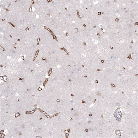 Laminin Alpha 2 Monoclonal Antibody Cl3450 Invitrogen 100 μl