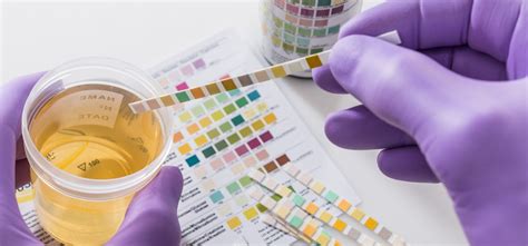 Urine Color Chart