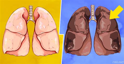 7 Consejos Para Limpiar Tus Pulmones