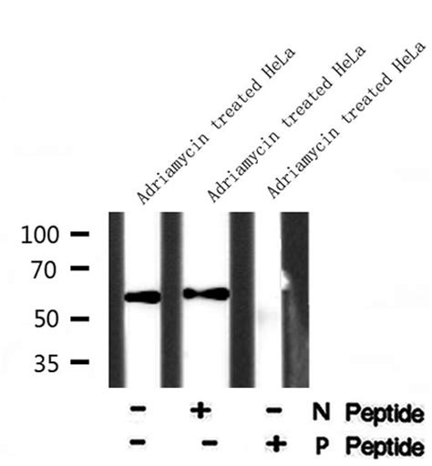 Phospho Tgfbr1 Ser165 Antibody Pa5 105818