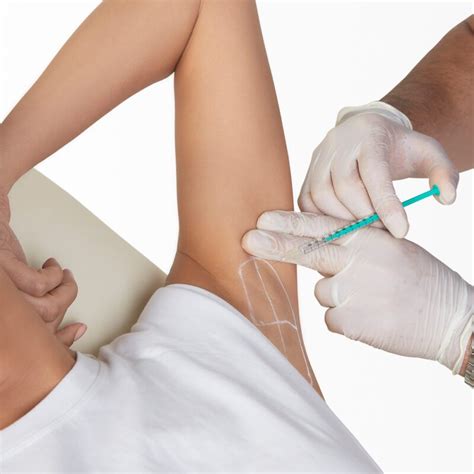 Excessive Sweating Dr Band Clinic