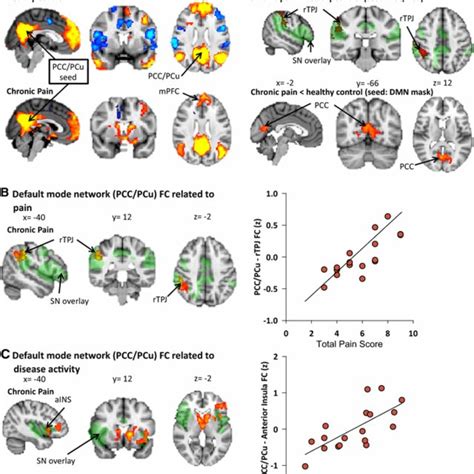 Primary Motor Cortex M1 Connectivity A The Location Of The M1 Seed Download Scientific