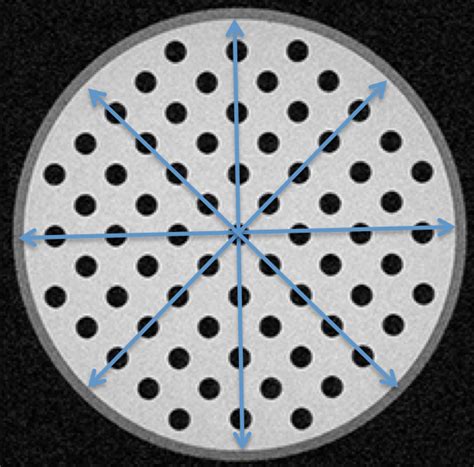 Geometric Accuracy Mri Phantom Questions And Answers In Mri