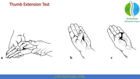 Hip Joint Osteoarthritis Artofit