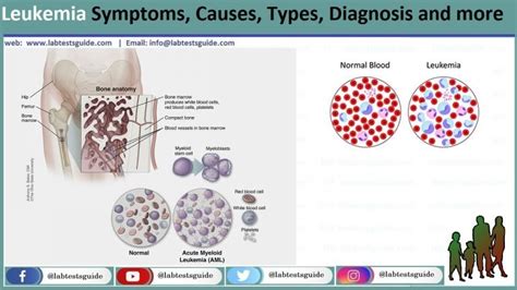 Anemia Symptoms Causes Types Diagnoses And More Lab Tests Guide