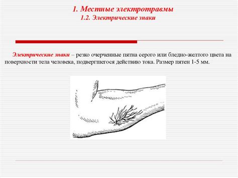 Действие электрического тока на организм человека Лекция 6 презентация онлайн