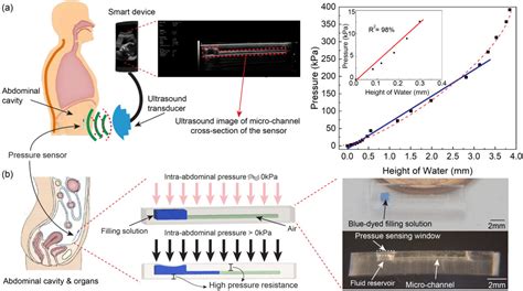 A Wireless Implantable Passive Intra Abdominal Pressure Sensing Scheme