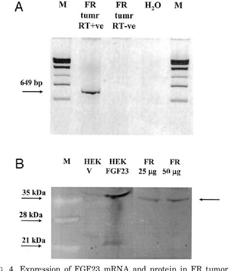 Figure 4 From Fibroblast Growth Factor 23 A New Clinical Marker For
