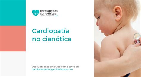 Cardiopatía no cianótica Cardiopatías Congénitas La Paz