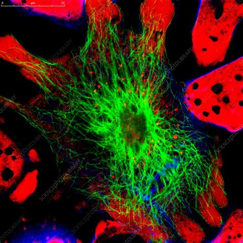 Neuroblastoma Cells Fluorescence Light Micrograph Stock Image C Science Photo Library