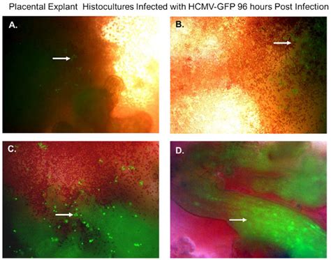 Placental Explant Histocultures Infected With Hcmv Gfp Placental