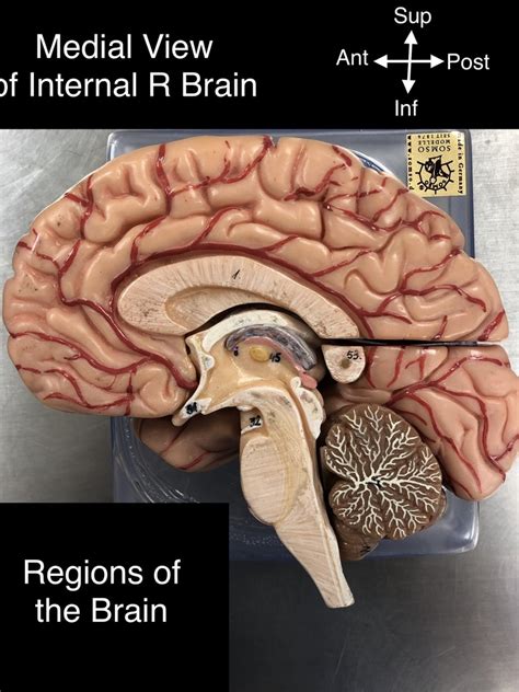 Brain Diagram Quizlet