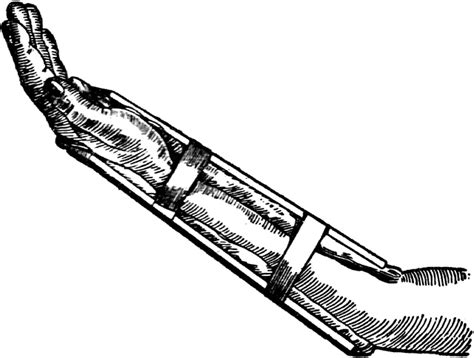 Arm Splint Clipart 9 Free Cliparts Download Images On Clipground 2025