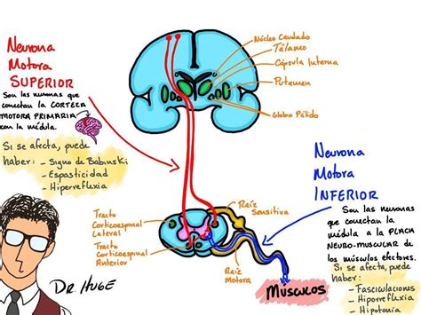 Características De Lesión Neurona Motora Inferior Causas Y Síntomas