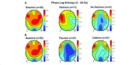 Topography Of Phase Lag Entropy 2 20 Hz Presented A At