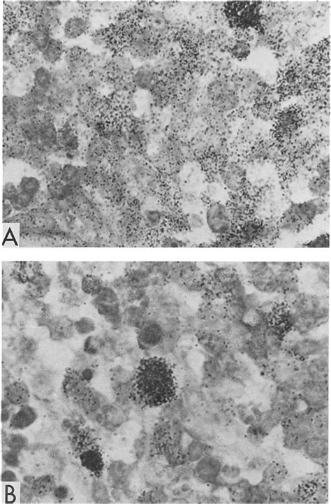 Sections Of A Popliteal Lymph Node Infused With 3h Leucine Via An