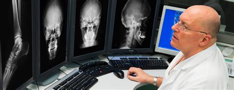 X Rays Of Skull